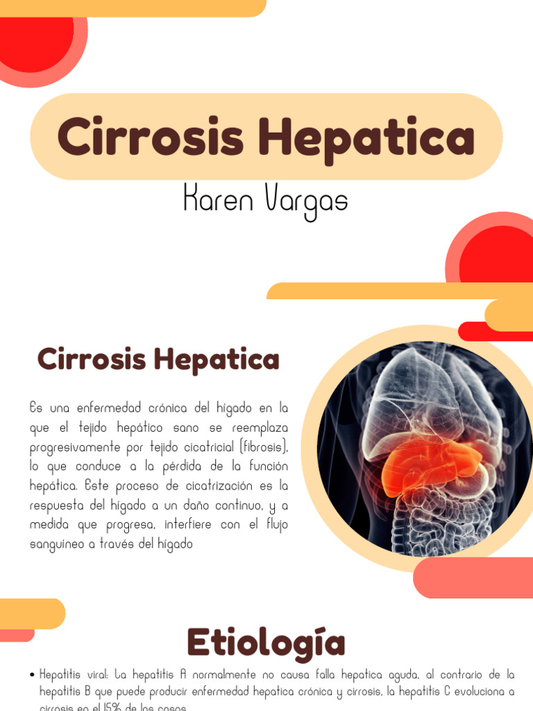 Cirrosis Hepática | PDF | Cirrosis | Hepatitis