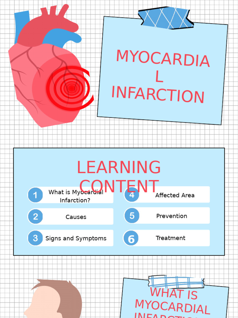Understanding Myocardial Infarction | PDF | Myocardial Infarction ...