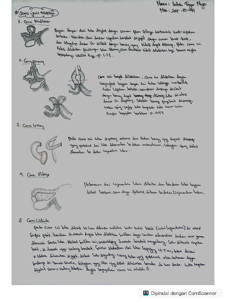 Tugas Obgyn - Indah F Ningsi - Jenis Jenis Tubektomi | PDF