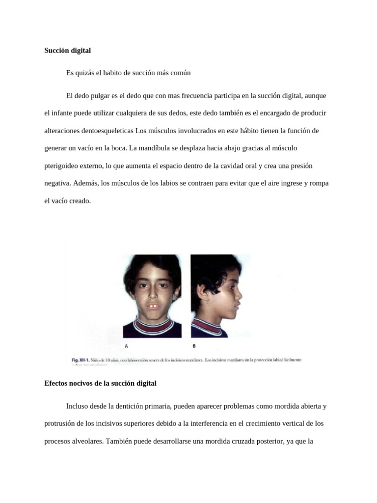 Succión Digital | PDF | Estilo de vida