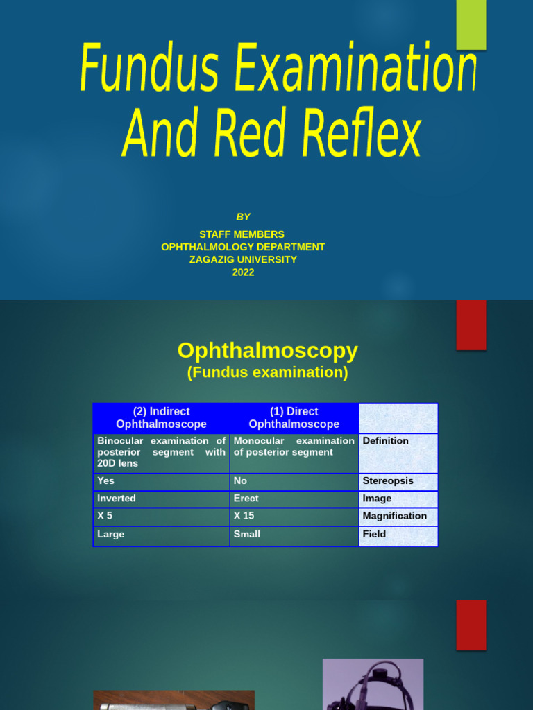 Fundoscopy Techniques for Cataract Exam | PDF | Human Eye | Cataract