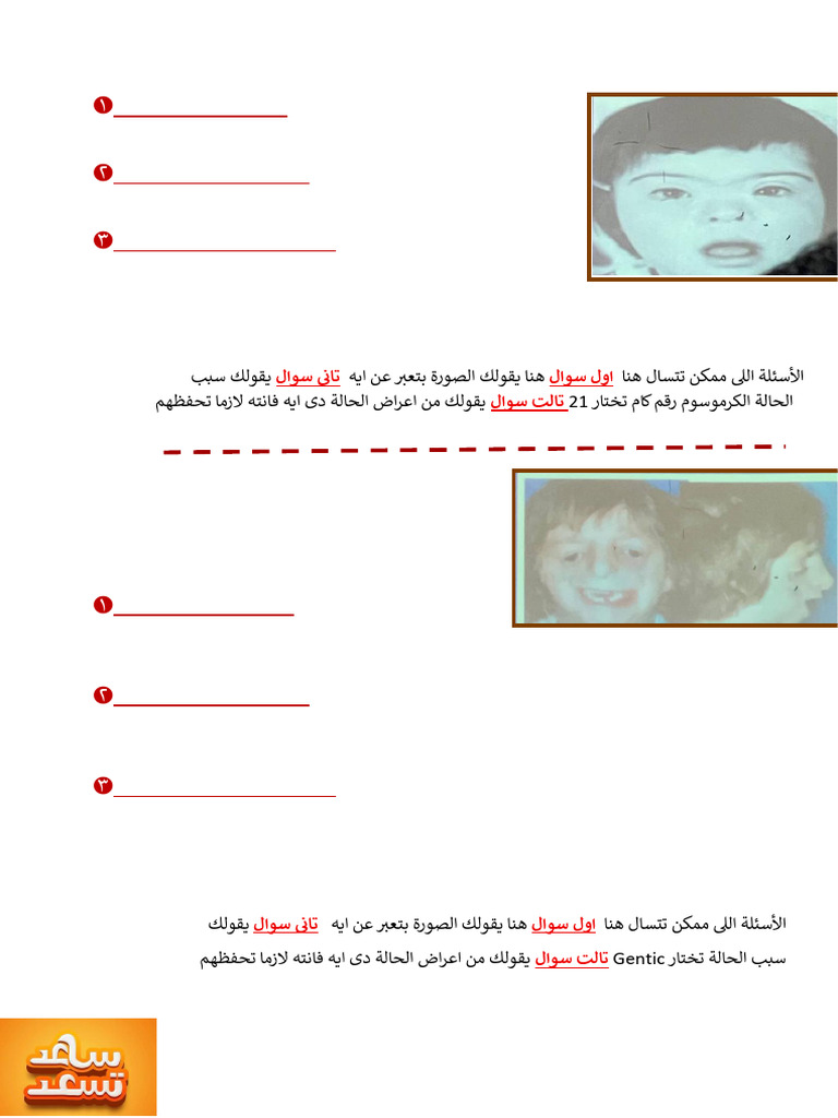 Identifty This Picture: Down"S Syndroma - Mongolism | PDF