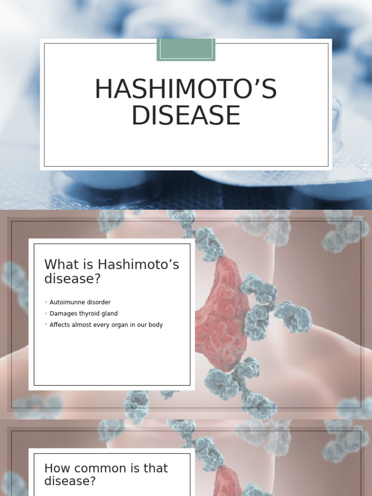Hashimoto | PDF