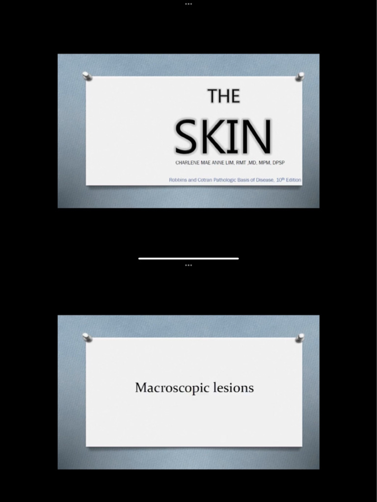 SKIN | PDF