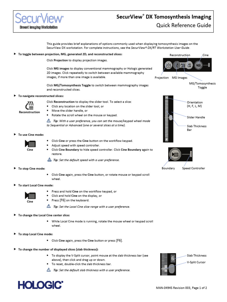SecurView DX Tomosynthesis Guide | PDF | Cursor (User Interface ...