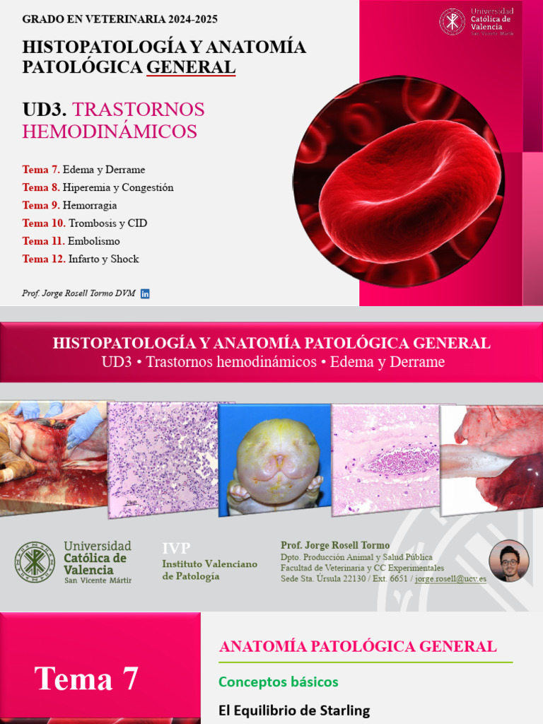 Ud3. Trastornos Hemodinámicos | PDF | Edema | Hemostasia