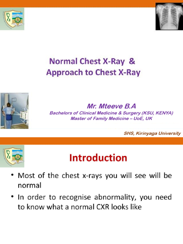 Approach to X-ray | PDF | Medicine | Health Care