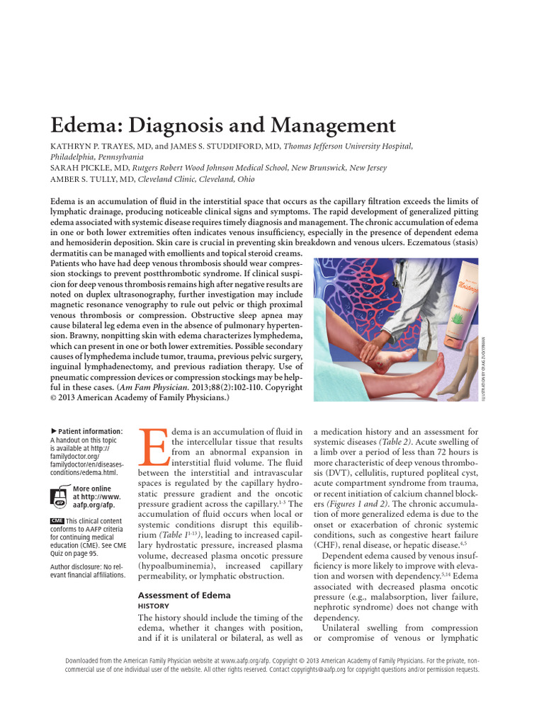 Edema Diagnosis and Management | PDF | Edema | Vein