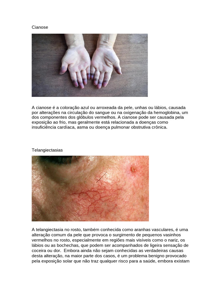 Lesões Dermatológicas e Cianose | PDF | Sangue | Corpo humano