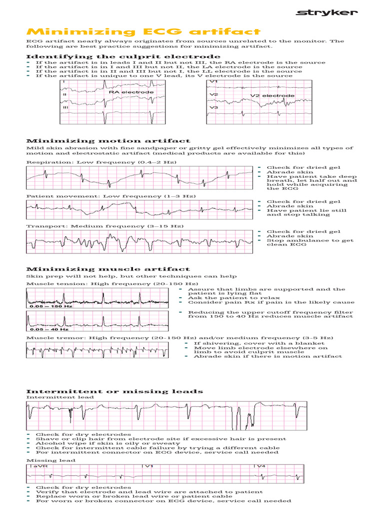 Minimizing Ecg Artifact Pocket Guide | PDF | Artificial Cardiac ...