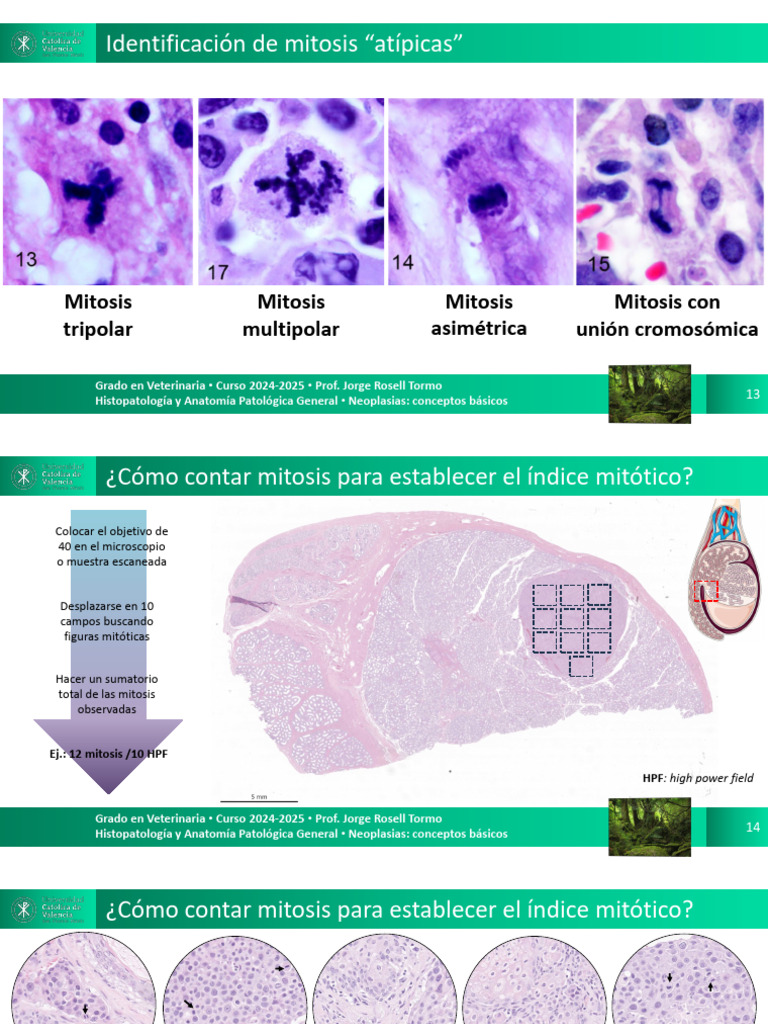 Ud8. Neoplasias y Biología Tumoral | PDF | Histopatología | Cáncer