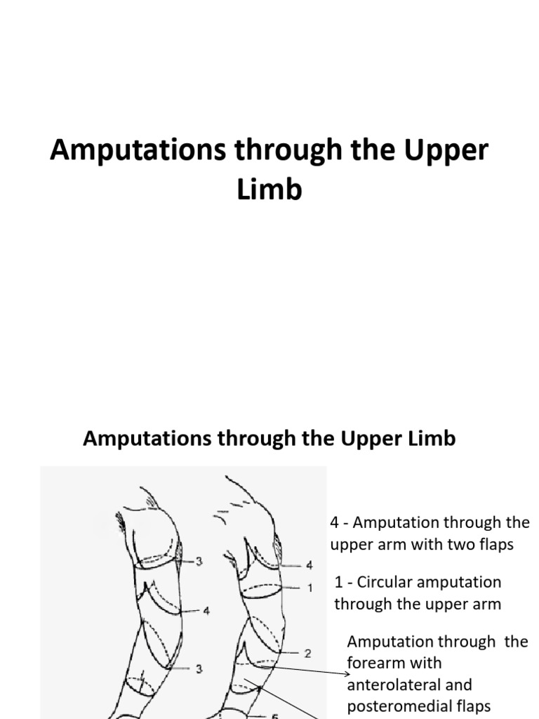Amputations Through The Upper Limb | PDF | Prosthesis | Finger
