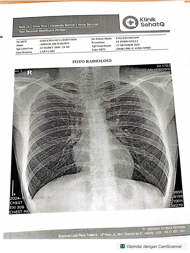 Hasil rontgen Ahmad Ari Wibowo | PDF