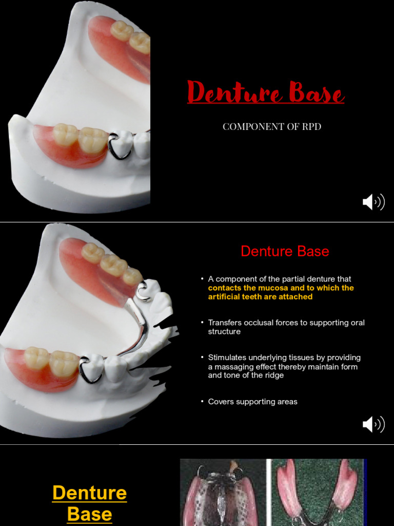 RPD Denture Bases | PDF | Dentures | Dentistry Branches