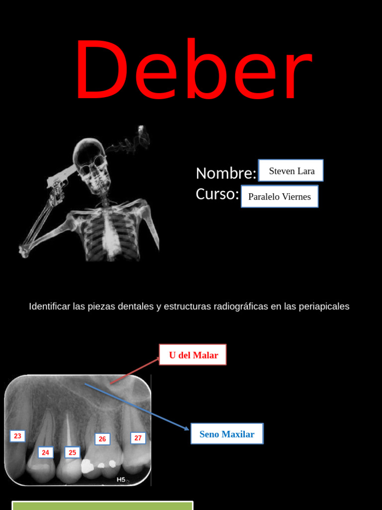 Taller Anatomia Intraorales y Panoramica (STEVEN LARA) | PDF