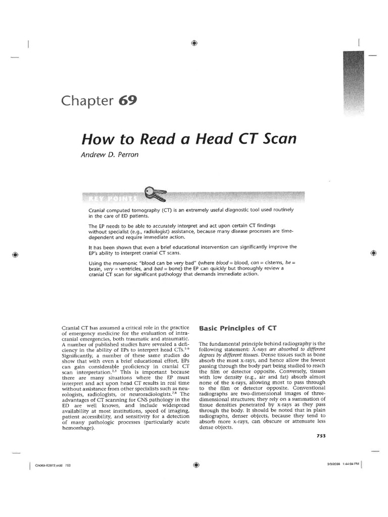 How to Read a Head CT Scan | PDF