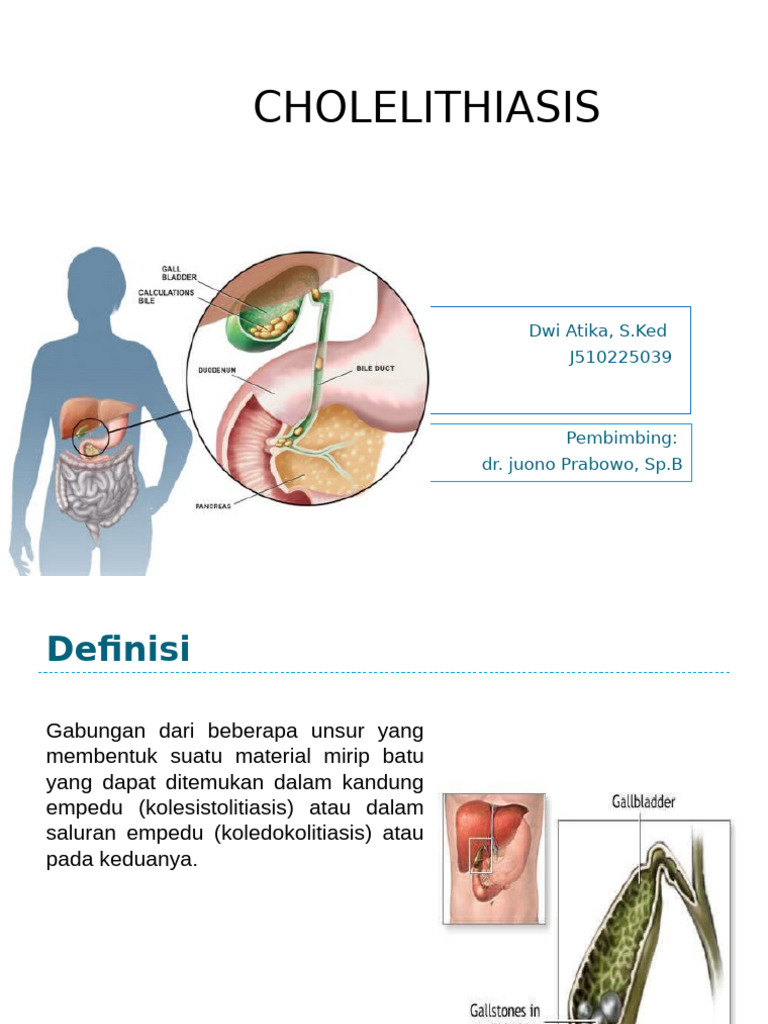 Tika Kolelitiasis PPT - Bedah | PDF