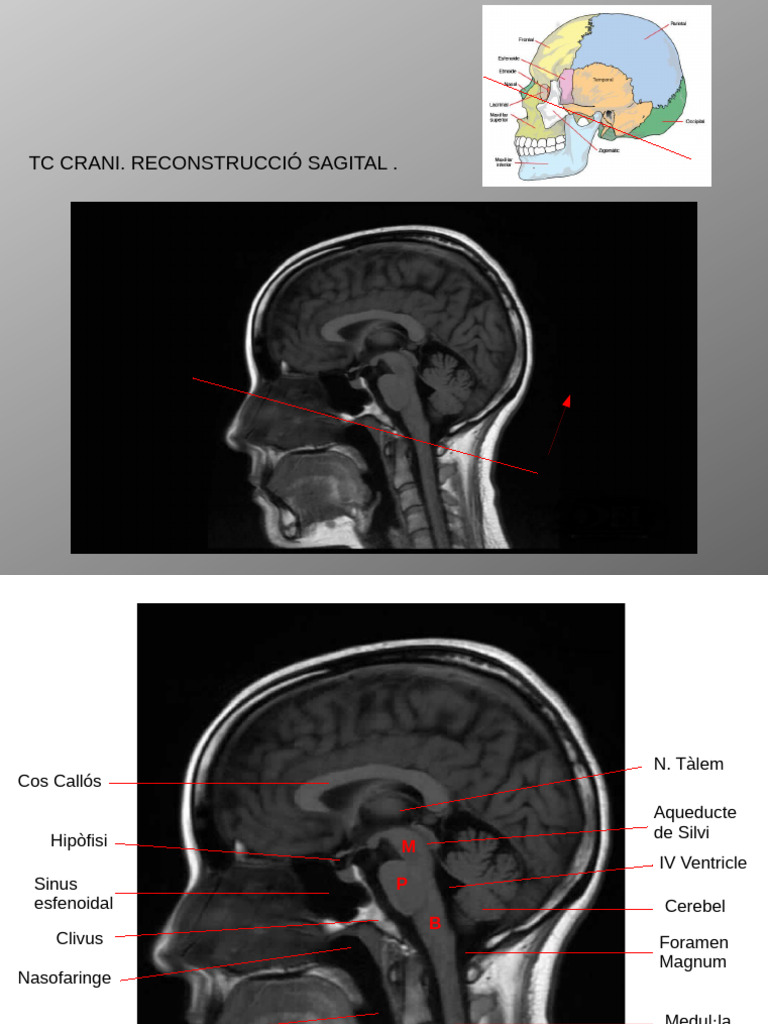 TC Crani | PDF