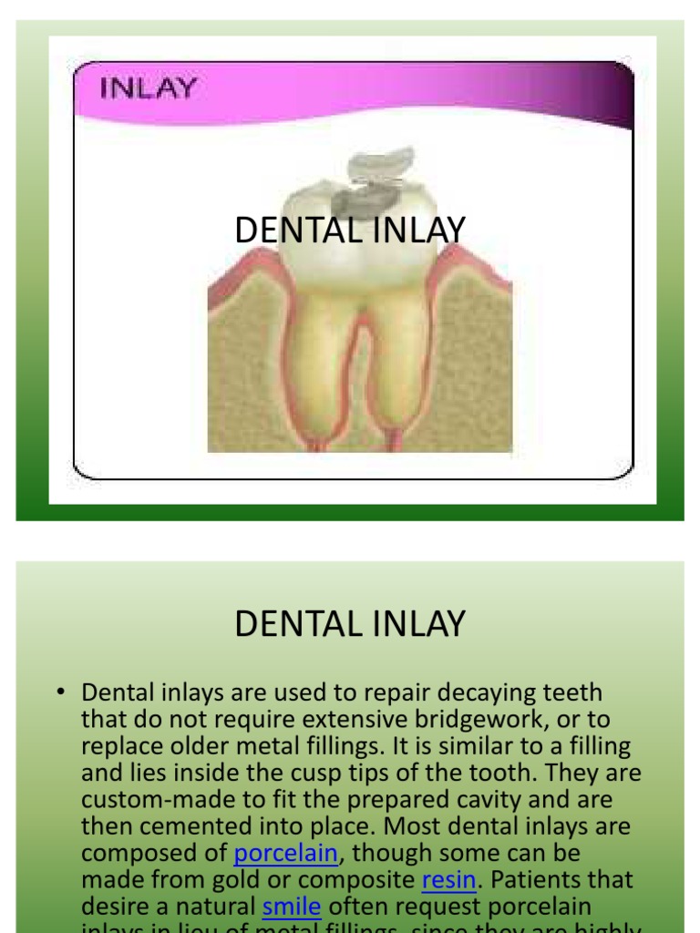 Dental Inlay Preparation | PDF | Dental Composite | Dentistry