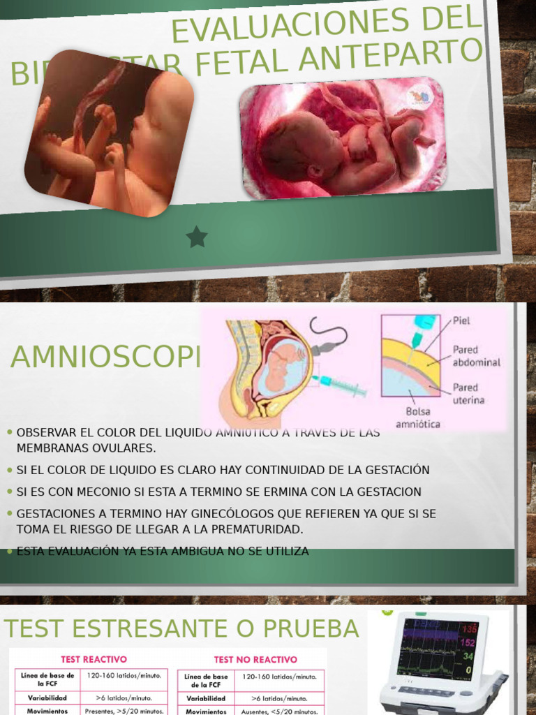 Evaluaciones Del Bienestar Fetal Anteparto | PDF | El embarazo ...