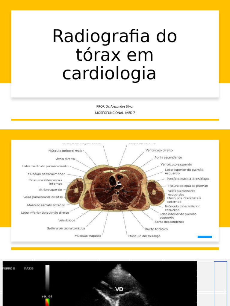 Radiografia Do Tórax Coração | PDF
