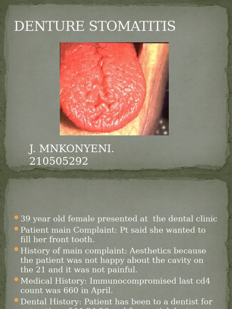 Denture Stomatitis Seminar | PDF | Dentures | Health Sciences