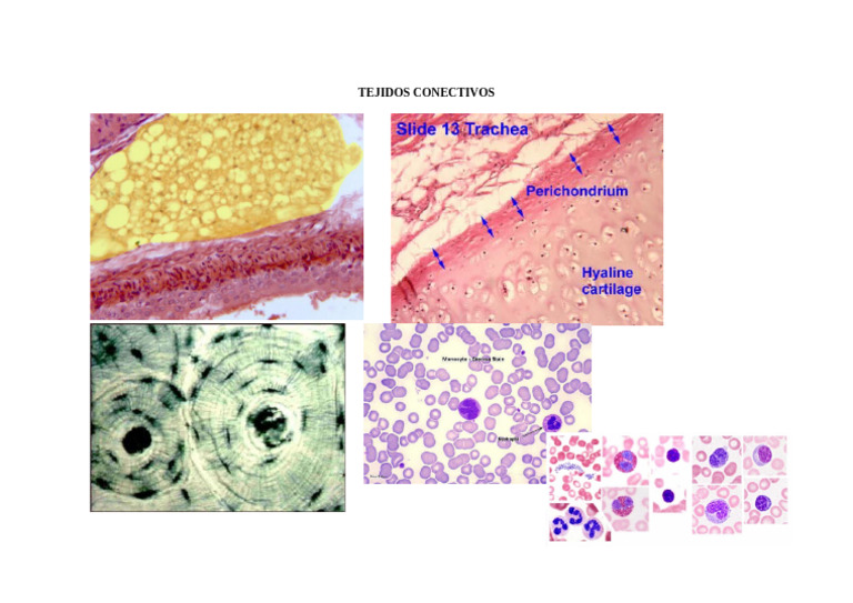 Tejidos Conectivos | PDF
