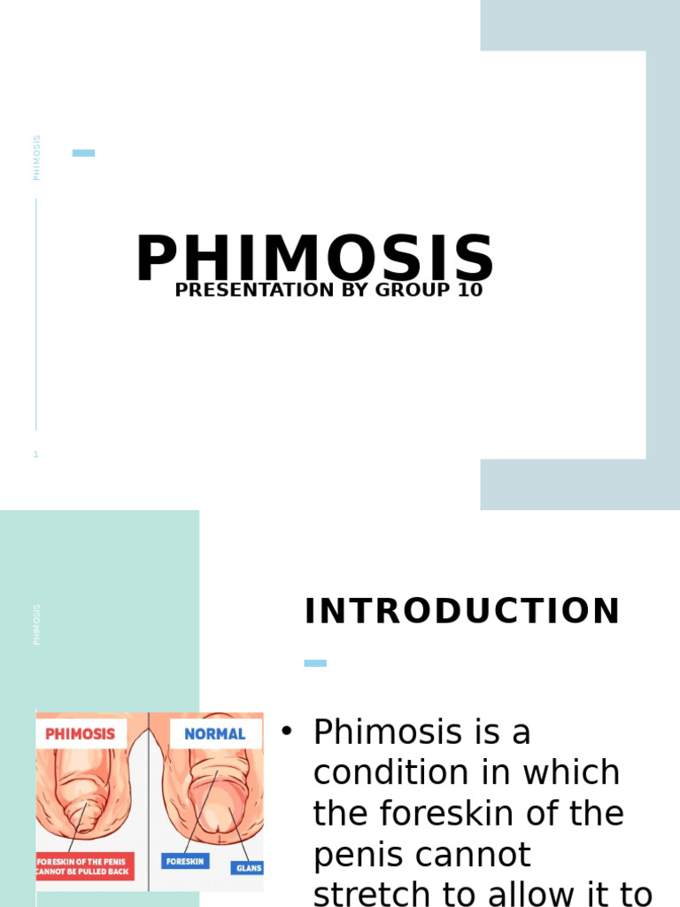 Phimosis, Paramophisis & Varicocele (Surgery III) GROUP 10-1 | PDF | Penis | Urology