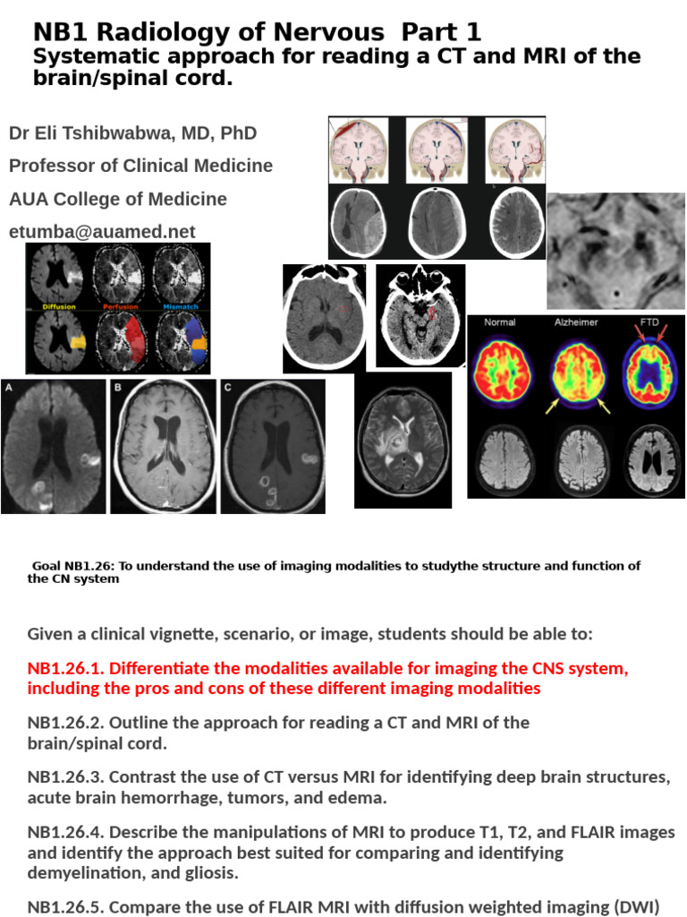 Radiology Nervous System Part 1 | PDF | Magnetic Resonance Imaging ...