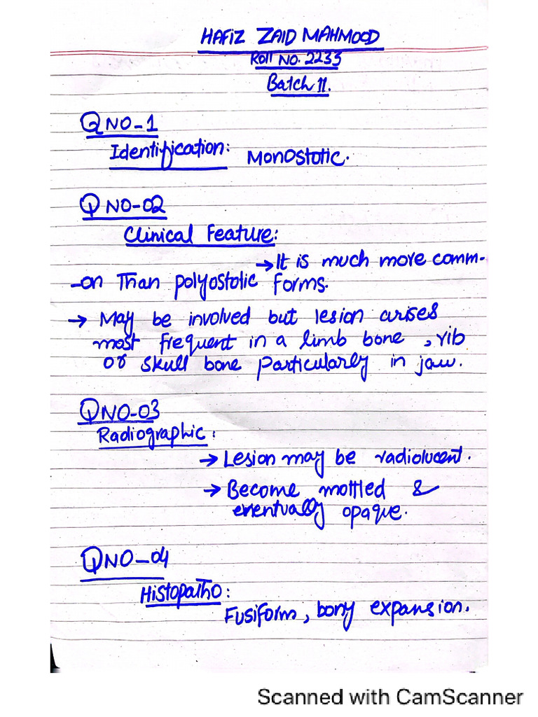 Monostotic Fibrous Dysplasia-ZAID | PDF