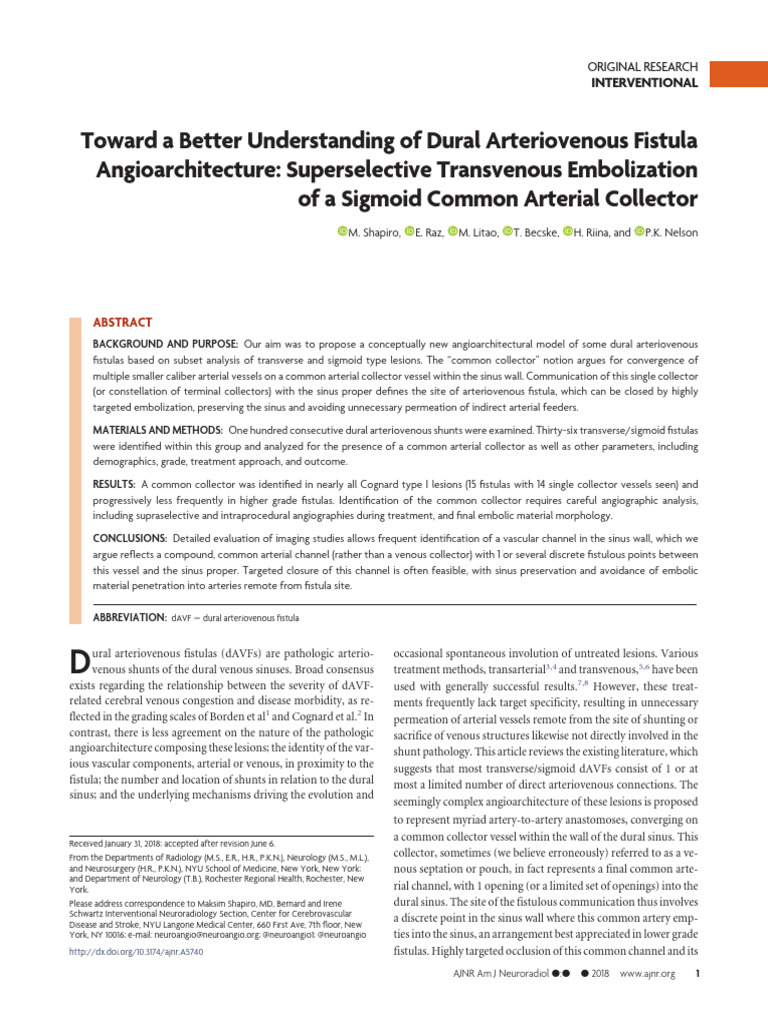 Toward A Better Understanding of Dural Arteriovenous Fistula ...