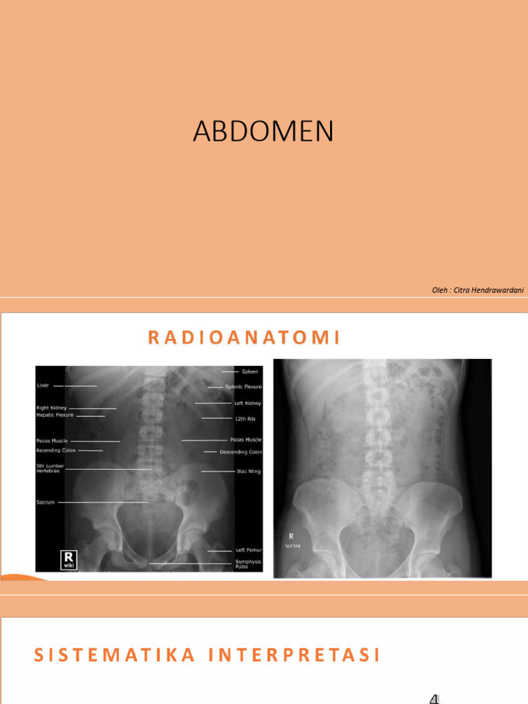 Interpretasi Radiologi Abdomen | PDF