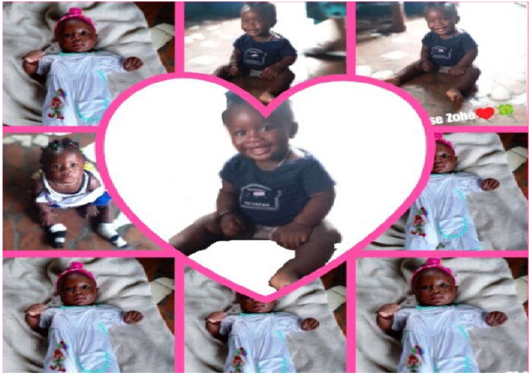 Photo Collage | PDF