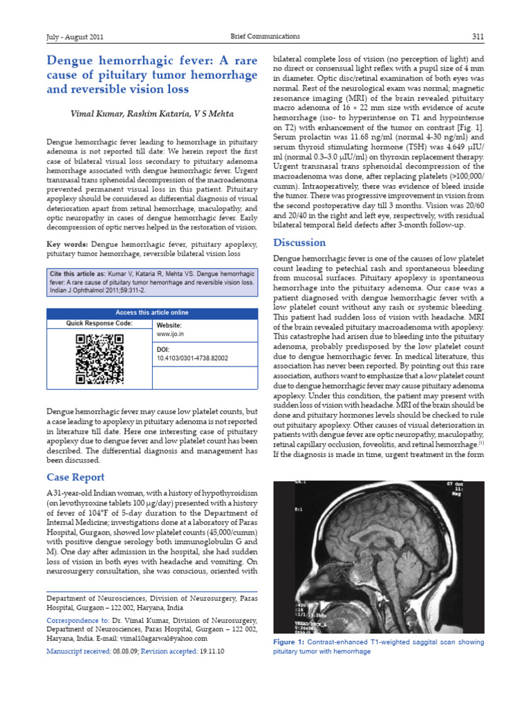 Dengue Hemorrhagic Fever A Rare Cause Of.11 | PDF | Diseases And ...