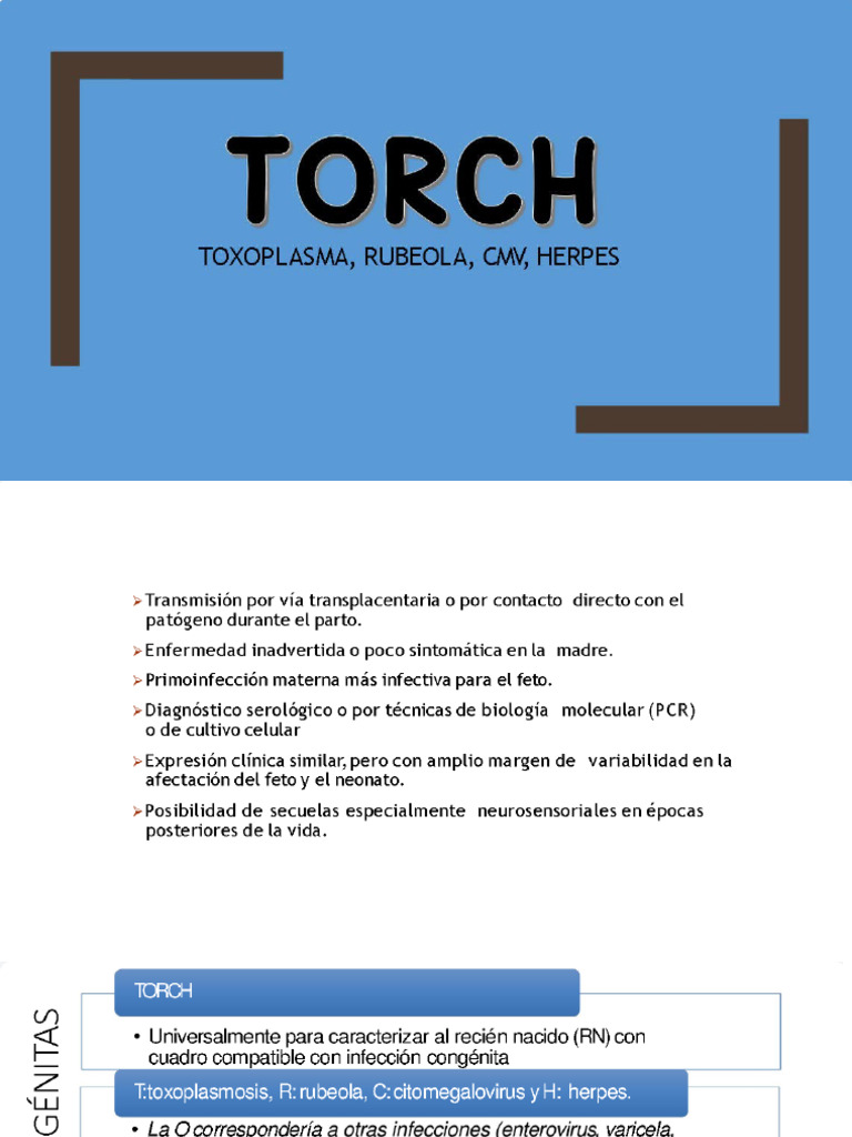 Torch | PDF