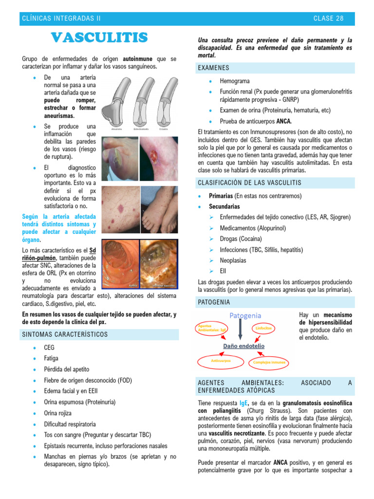 Vasculitis | PDF | Alergia | Inmunología
