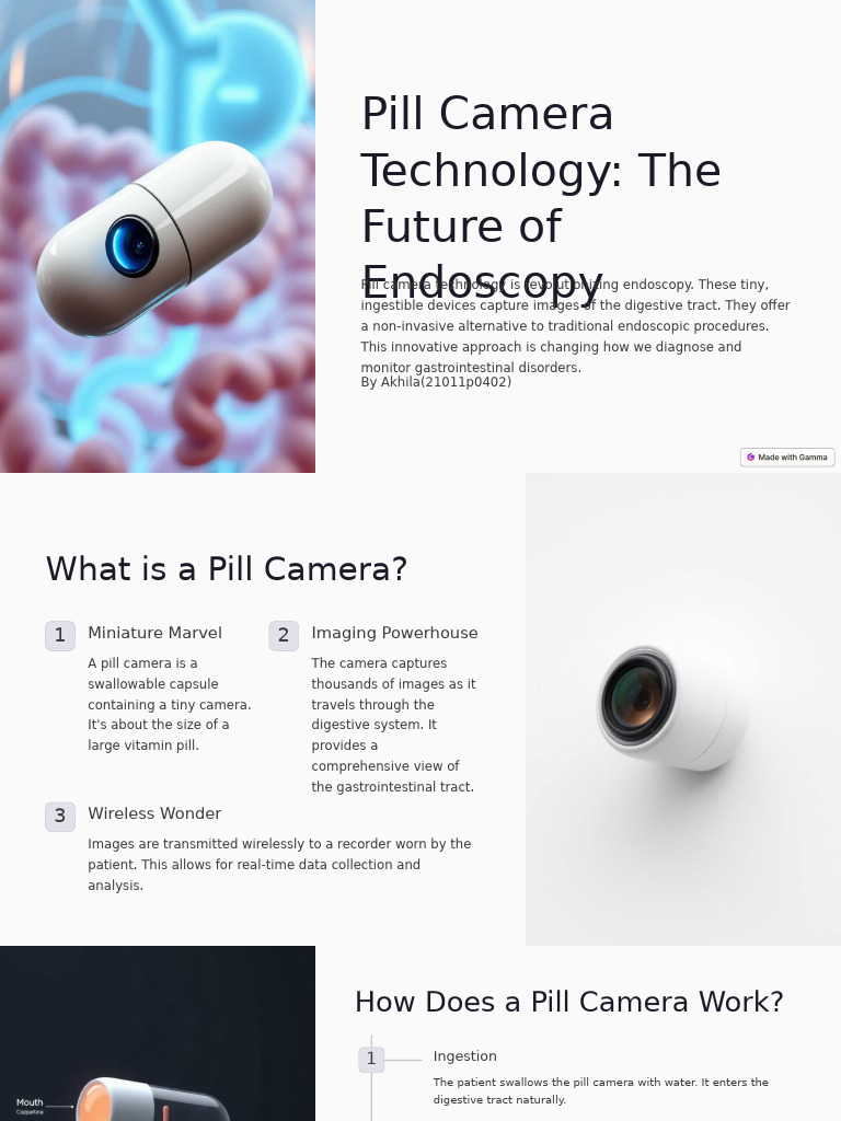 Pill Camera: Revolutionizing Endoscopy | PDF | Gastroenterology ...