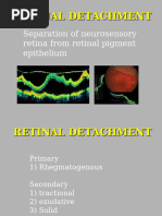 White Without Pressure | PDF | Vision | Ophthalmology
