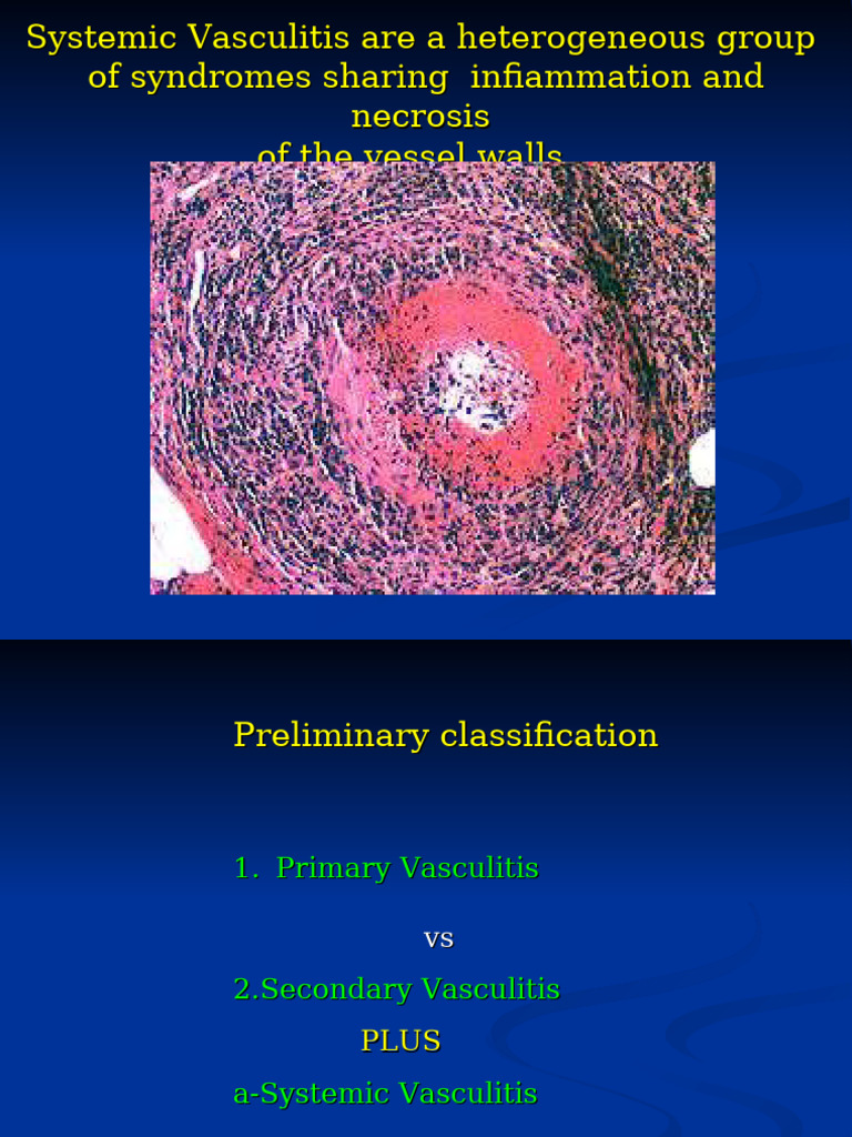 Understanding Systemic Vasculitis Types | PDF | Medical Specialties ...
