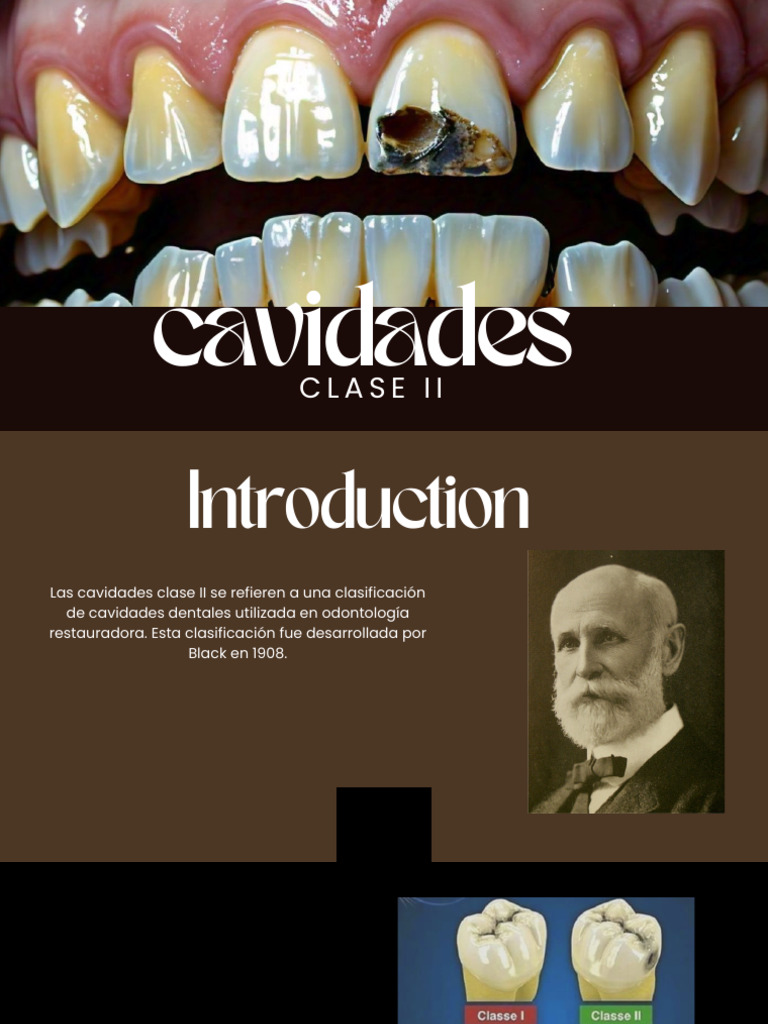 Clasificación y preparación de cavidades II | PDF | Ciencia y matemáticas