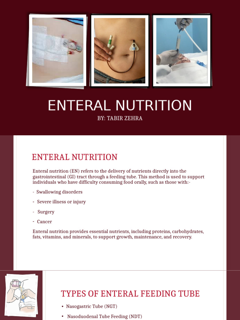 Enteral Nutrition (Final Draft) | PDF | Calorie | Nutrition