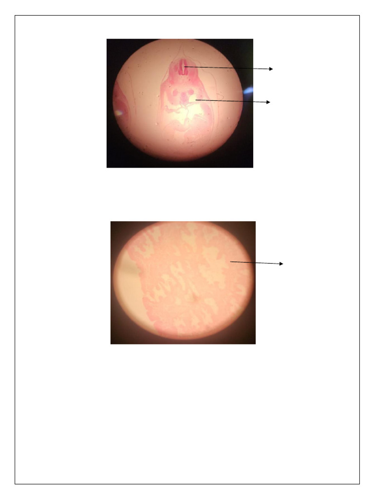 Trabajo Embriologia 2par | PDF
