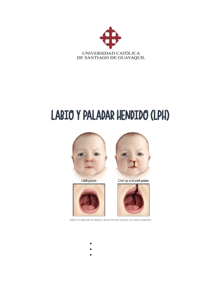 Labio Paladar Hendido | PDF | Especialidades Medicas | Medicina CLINICA