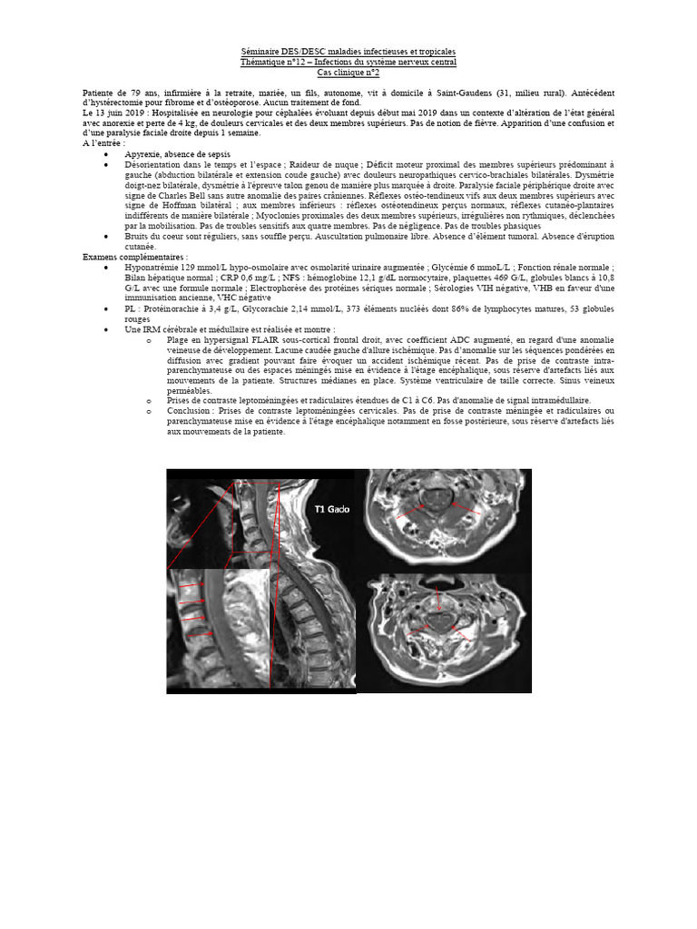 Signe de Hoffman bilatéral en neurologie | PDF | Causes de décès | Médecine