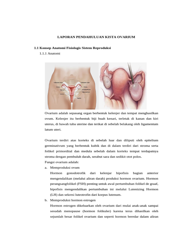 LP Kista Ovarium | PDF | Kesehatan Holistik | Sains & Matematika