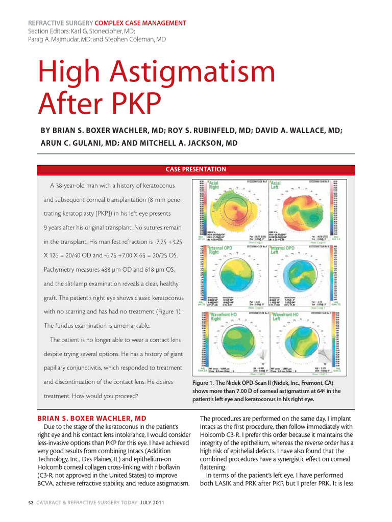 High Astigmatism After PKP | PDF | Myopia | Vision