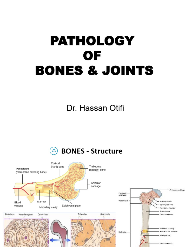 PATHOLOGY OF BONES & JOINTS (1) | PDF | Bone | Osteoarthritis