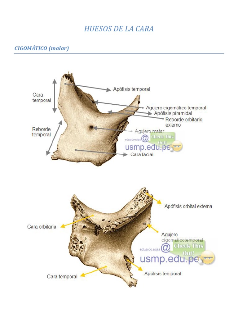 Anatomía del Hueso Cigomático | PDF
