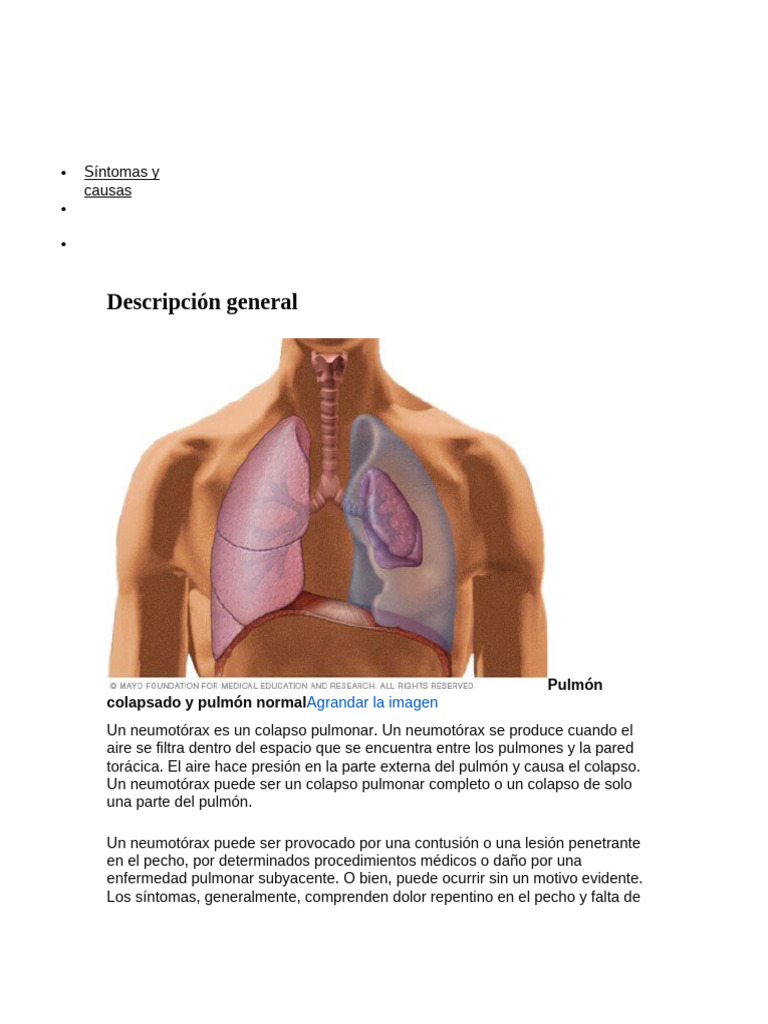 Neumotórax: Causas y Tratamiento | PDF | Enfermedades y trastornos ...