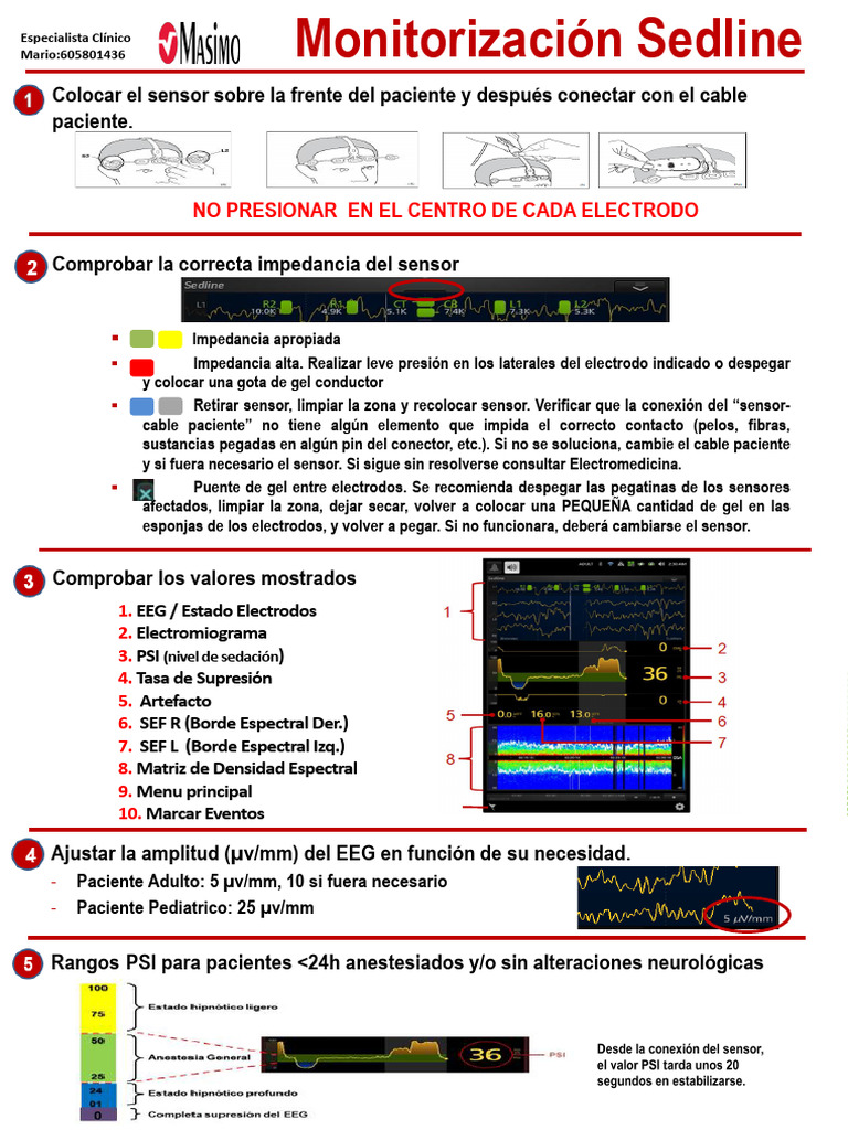Guia Sedline | PDF | Electromiografia